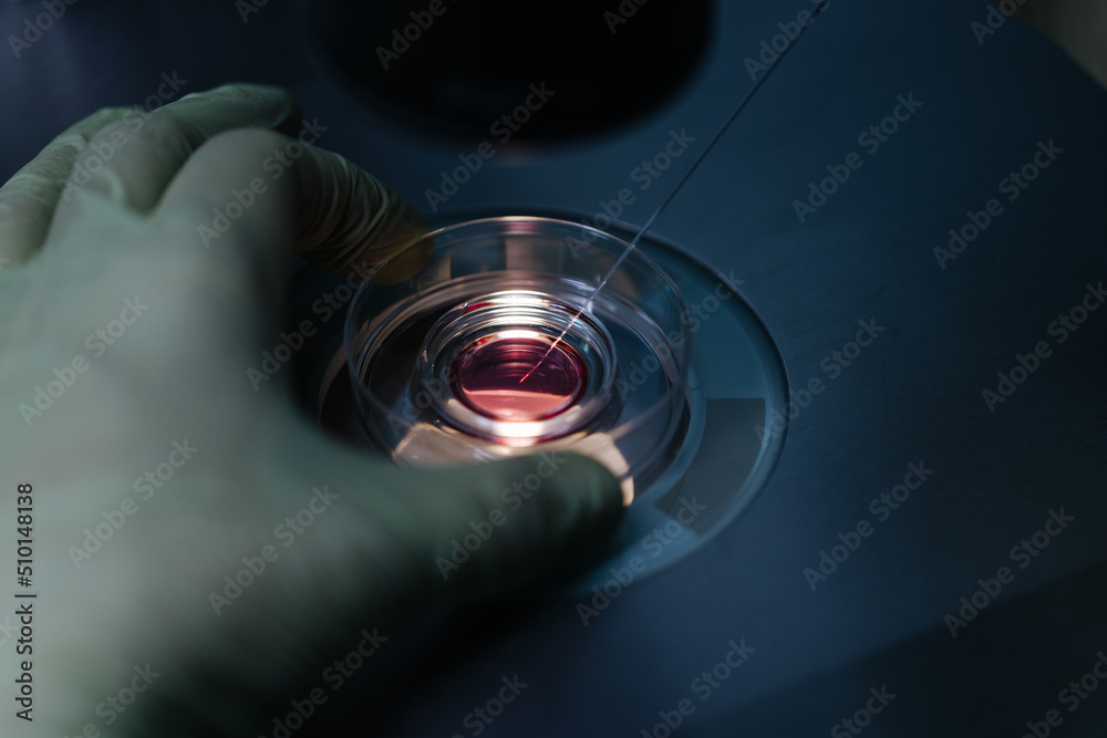 IVF procedure in petri dish in lab Stock Photo | Adobe Stock
