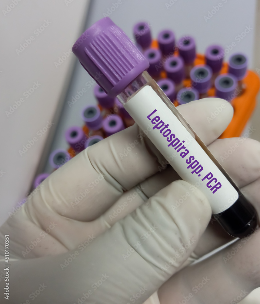 Blood sample for Leptospira Spp. PCR Test to identify Leptospirosis ...