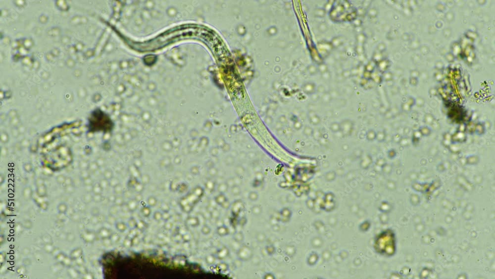 soil microorganisms nematode, microarthropods, micro arthropod ...
