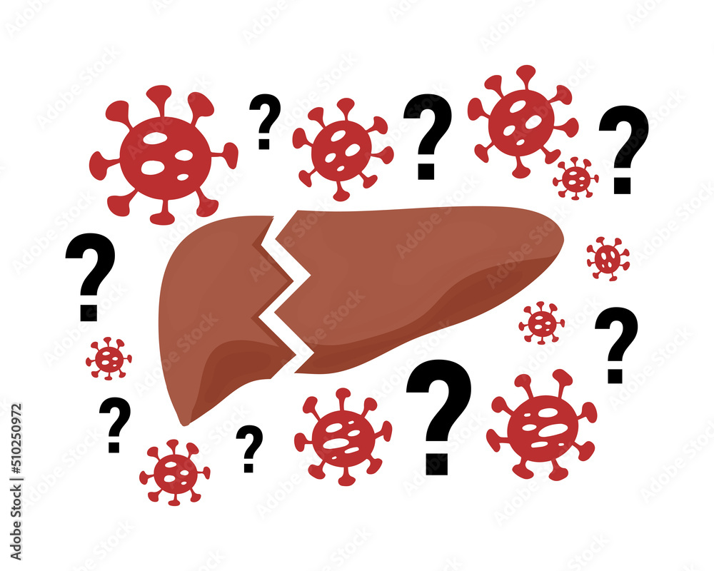 Mysterious Acute Hepatitis of Unknown Cause concept. Vector ...