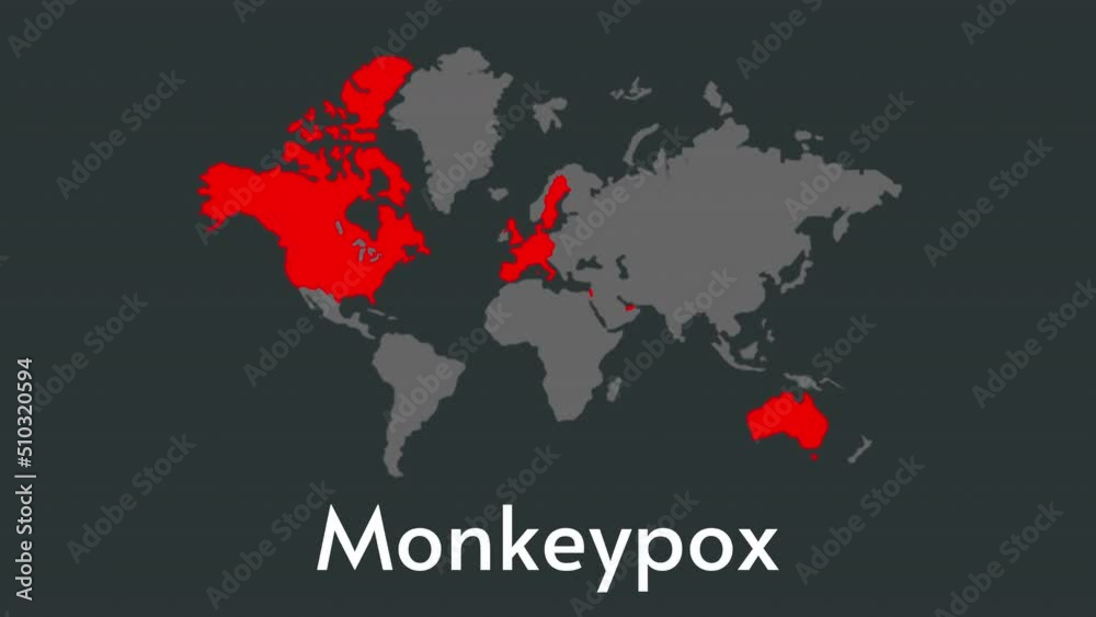 Map of monkeypox infections 2022. Epidemic 2022. Virus 2022. Animation ...