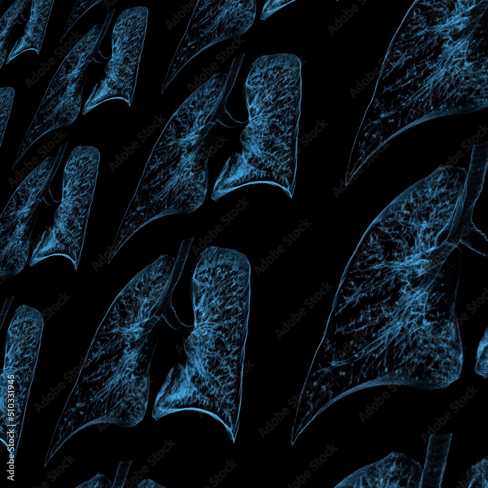 Chest ct scan 3d background vector blue and black Stock Vector | Adobe ...