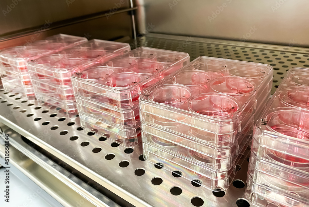 A set of cell culture plates with cancer cell seeded out for in vitro ...