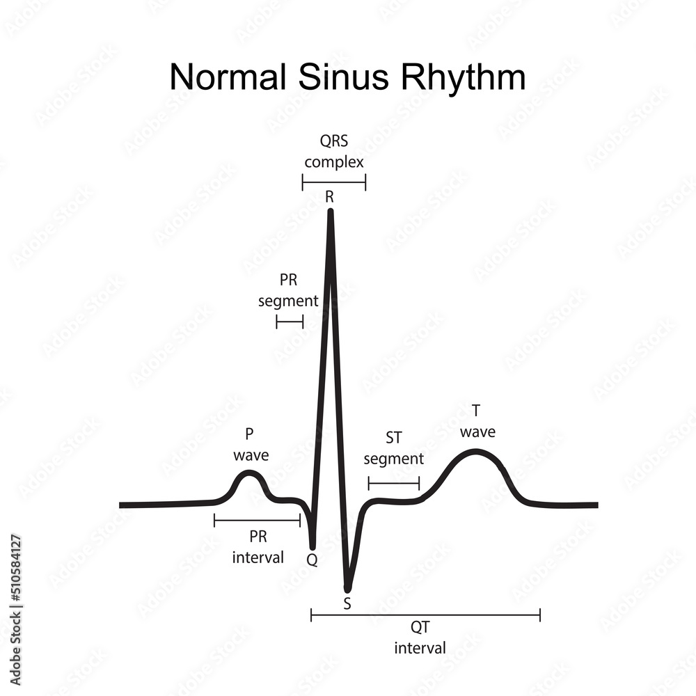 Normal Heart Rate Line
