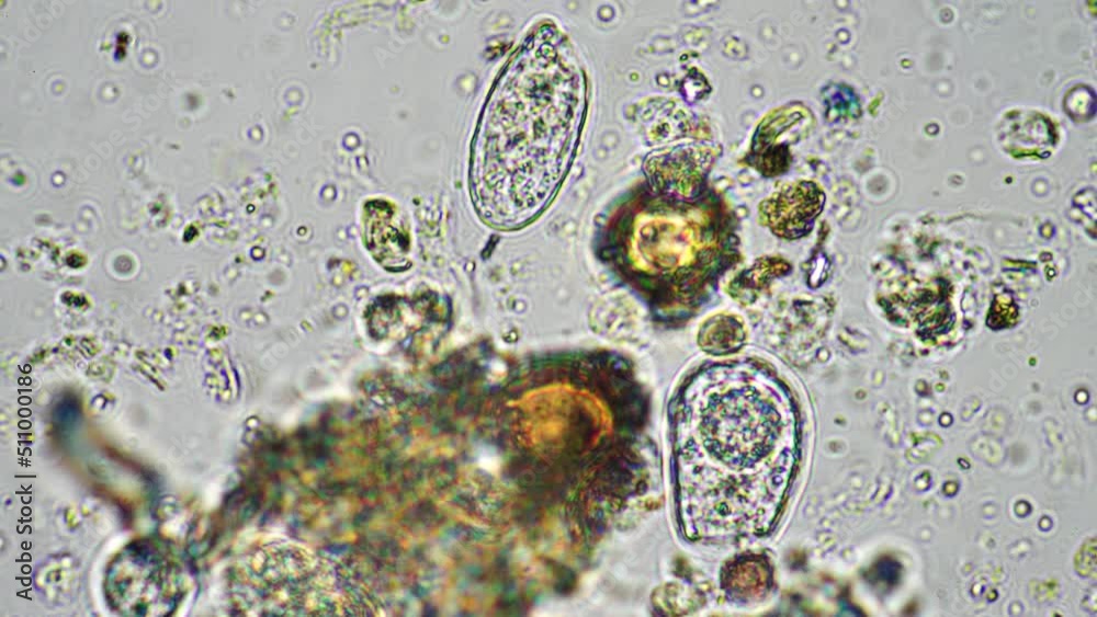 Scientist looking at a soil sample under the microscope. Studying a ...