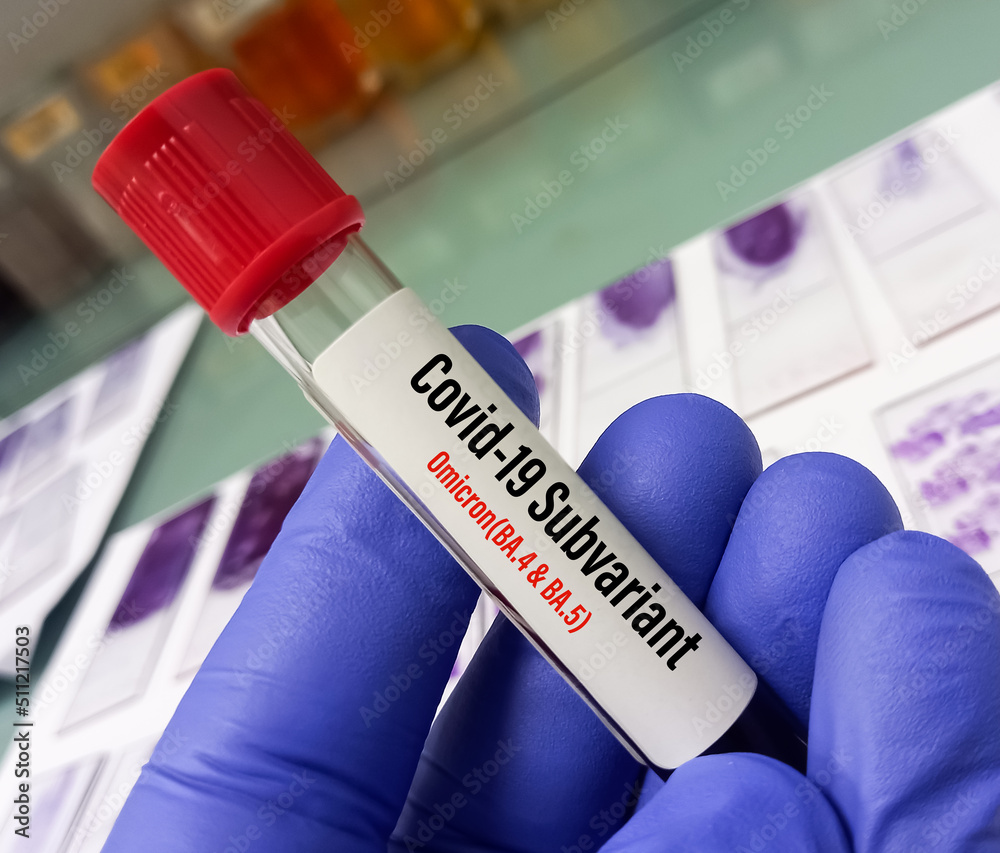 Blood sample for Covid-19 Subvariant omicron (BA.5 and BA.5) test ...