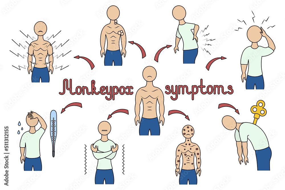 A group of signs of monkey pox. Color vector illustration. Cartoon ...