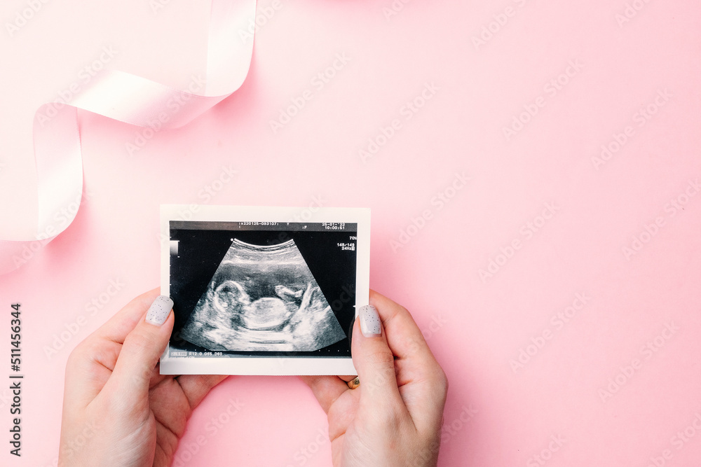 Ultrasound photo pregnancy baby. Woman hands holding ultrasound ...