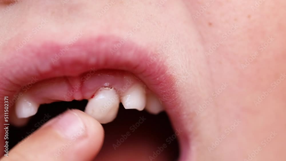 Video Stock Unrecognizable close up kid mouth, baby gingival milk teeth ...