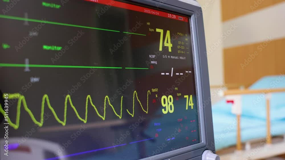 Electrocardiogram, EKG, heart rate monitor in hospital room for ...