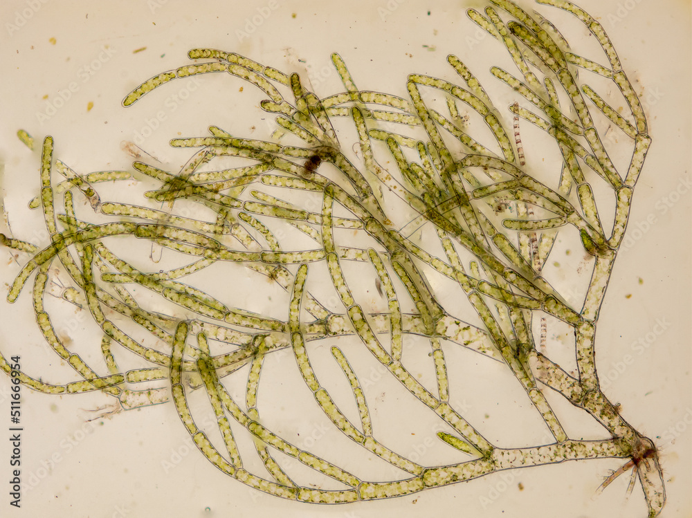 marine green algae under the microscope - optical microscope x100 ...