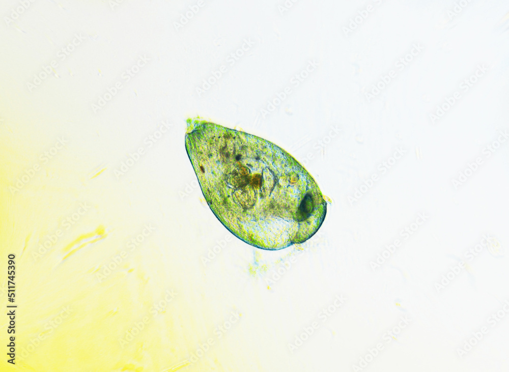 Ciliates Stentor