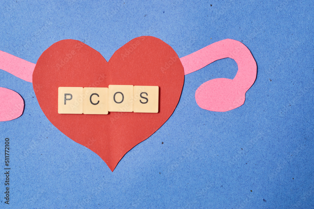 Concept polycystic ovary syndrome, PCOS. Women reproductive system ...