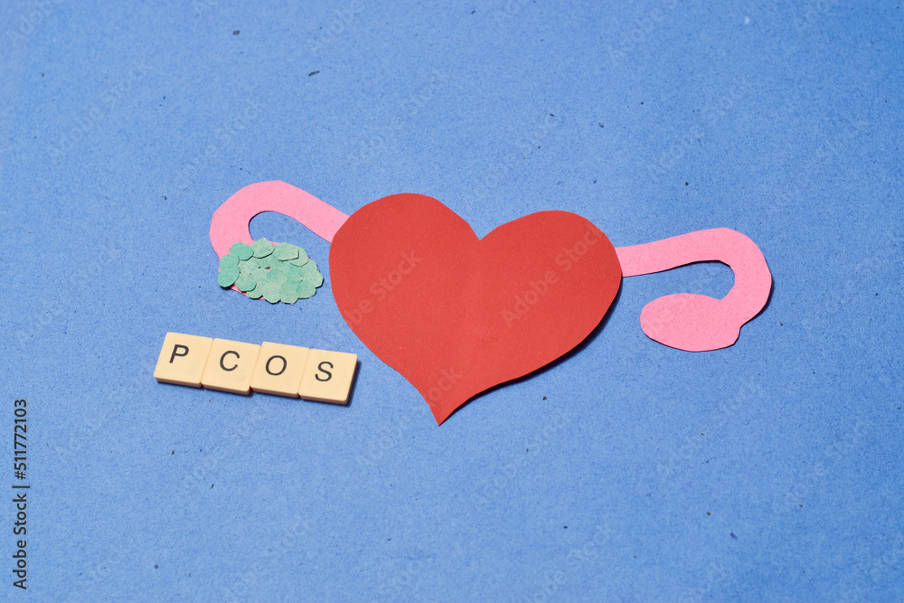 Concept polycystic ovary syndrome, PCOS. Women reproductive system ...