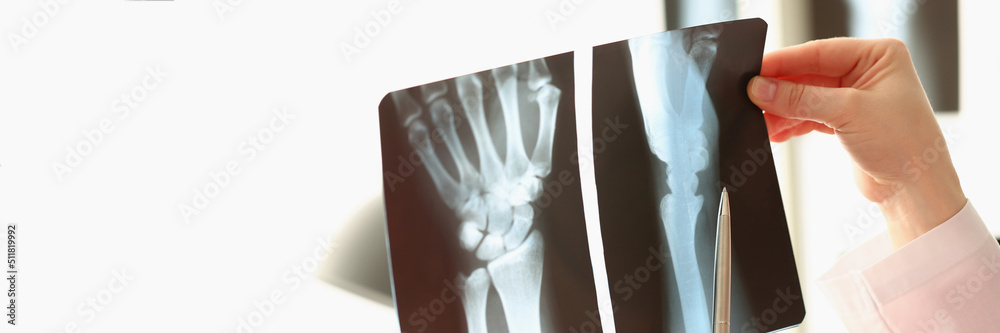 Female doctor looks at an x-ray of her hand Stock Photo | Adobe Stock