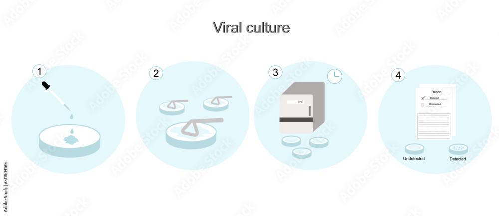 The methodology of Microbiological culture with spread plate technique ...