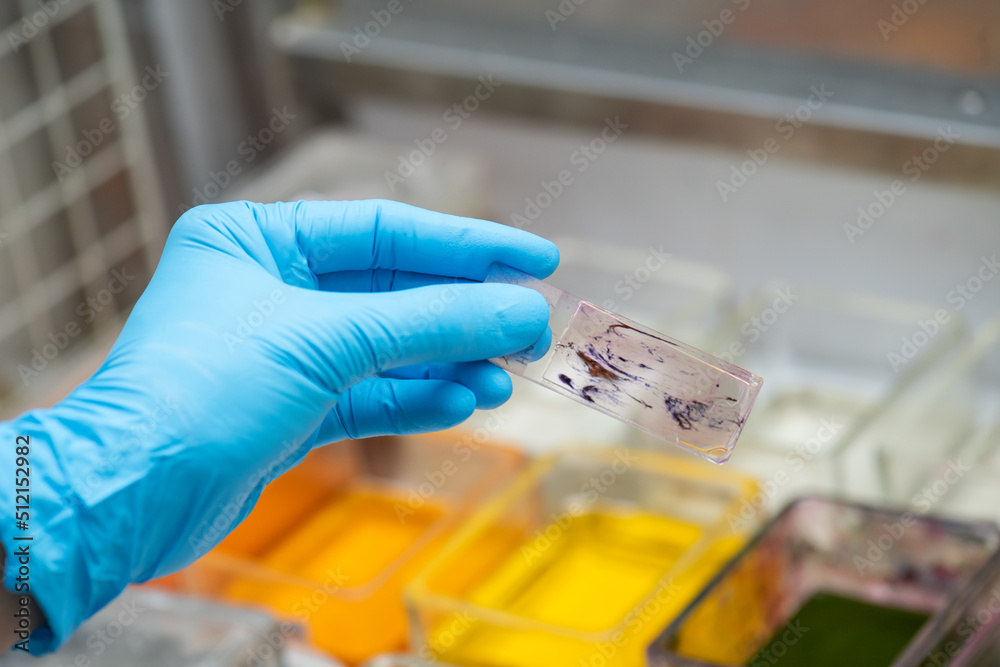Medical scientists are preparing cytology specimens to detect ...