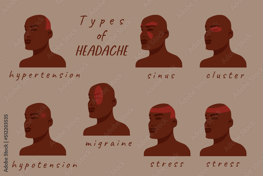 Medicine poster demonstrating types of headache of African American man ...