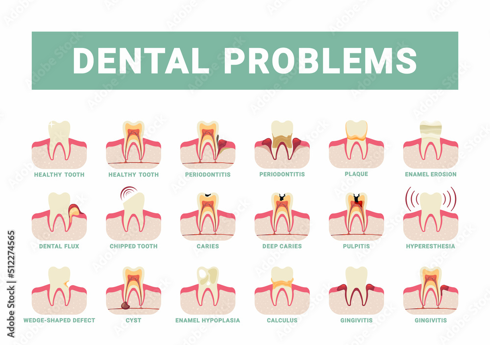 dental problems. infografic template with damaged teeth and bad oral ...