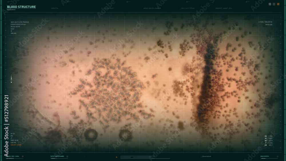 Analyzing the infection in the blood under the microscope. Microscopic ...