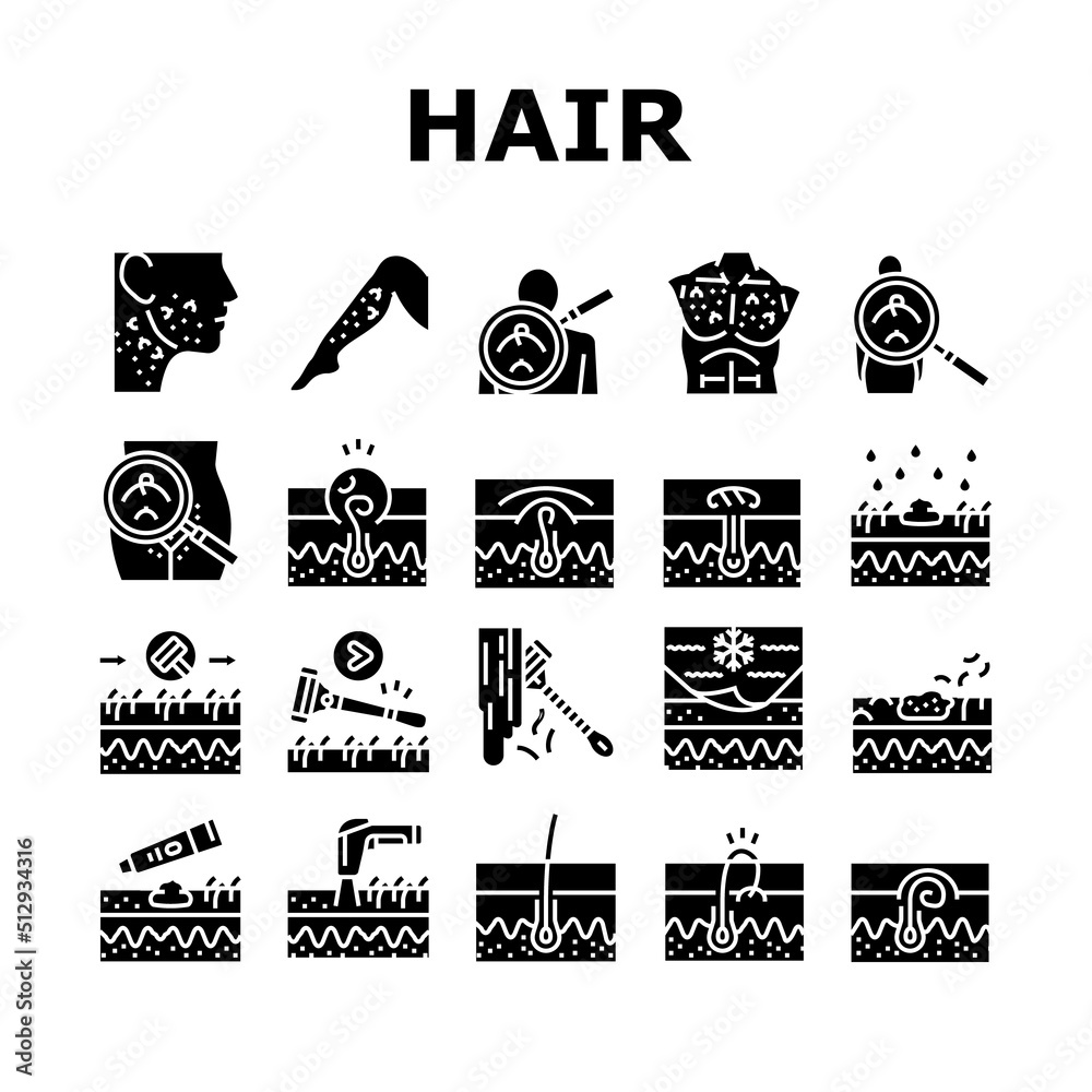 Ingrown Hair Problem Treatment Icons Set Vector. Ingrown Hair Shaving ...