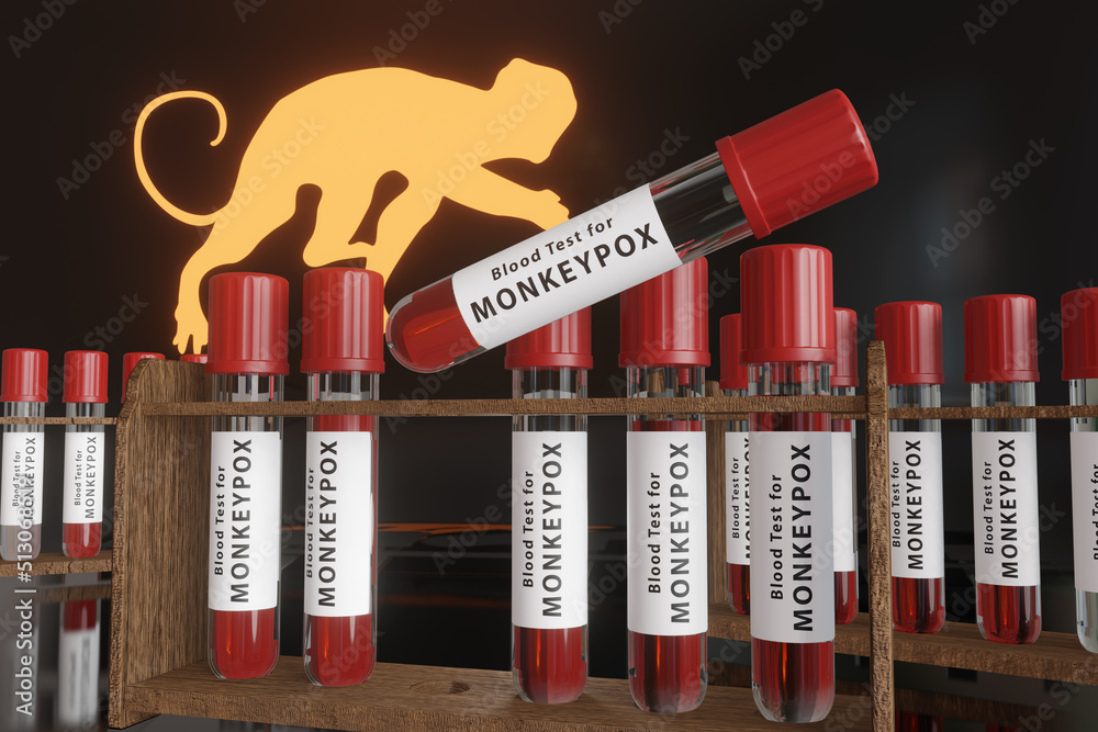 Test tube labelled as blood test for Monkeypox to illustrate the wide ...