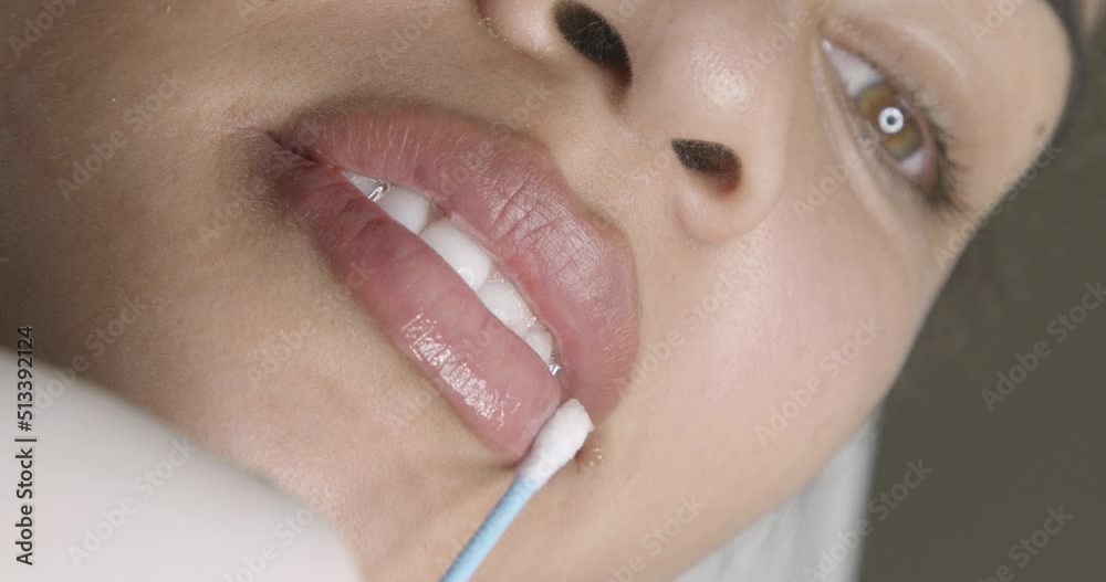 Anesthesia applied to the lip with ointment. Realization of lip ...