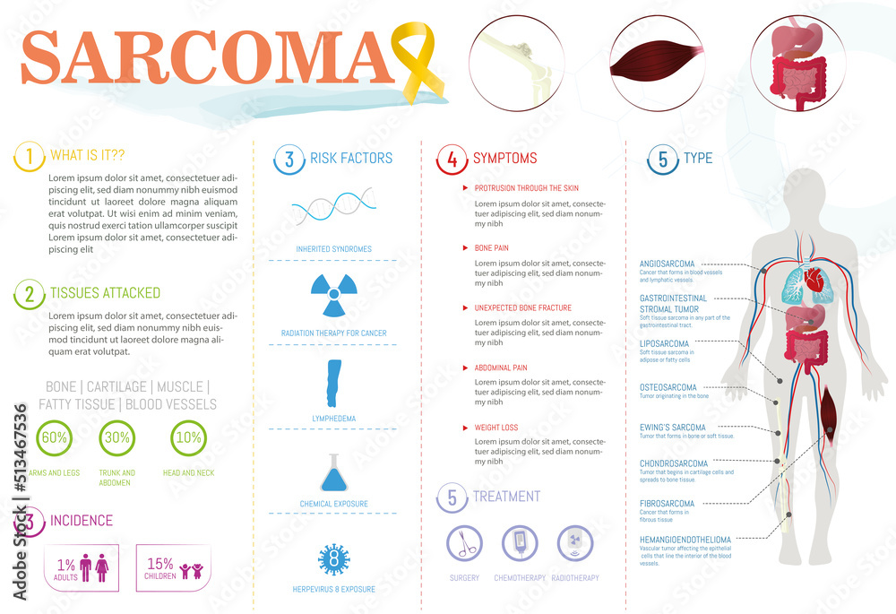 Infographic about Sarcoma disease, types, affected tissues, treatment ...