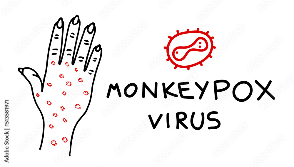 Monkeypox virus infection on hand drawing banner concept. Monkey pox ...