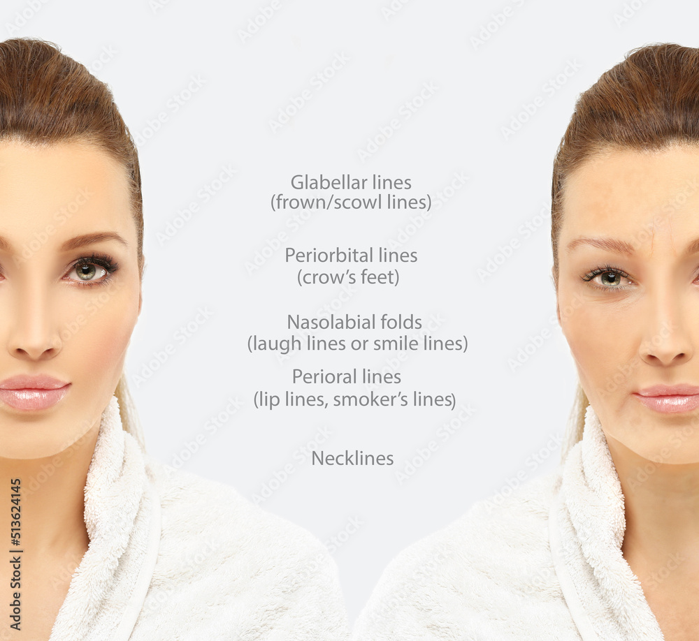 Ageing skin ,internal and external causes of skin aging, signs of skin ...