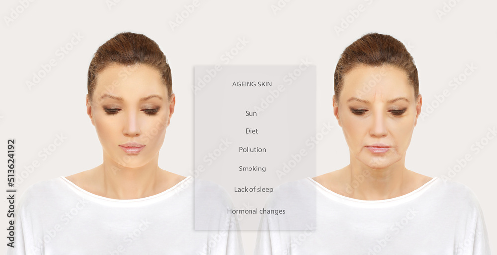 Ageing skin ,internal and external causes of skin aging, signs of skin ...