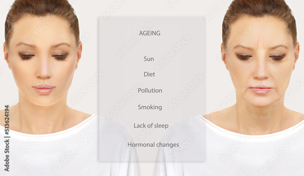 Ageing skin ,internal and external causes of skin aging, signs of skin ...