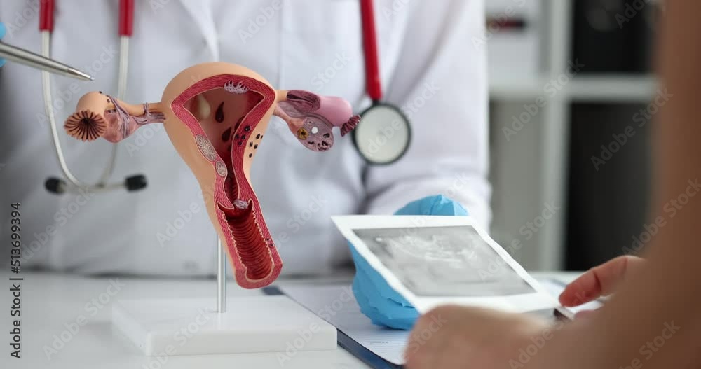 Gynecologist demonstrates model of female reproductive system to woman ...