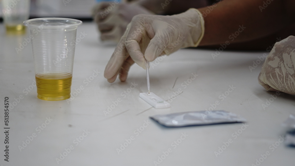 Substance abuse, drug detection, Police detect narcotics from urine ...