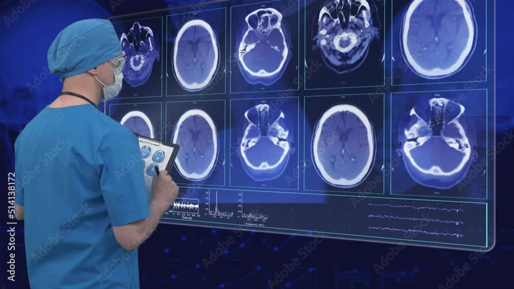 Mri scan on screen Stock Video | Adobe Stock