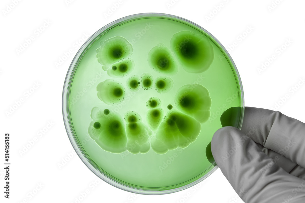 Hand with Petri dish or culture media with bacteria on white background ...