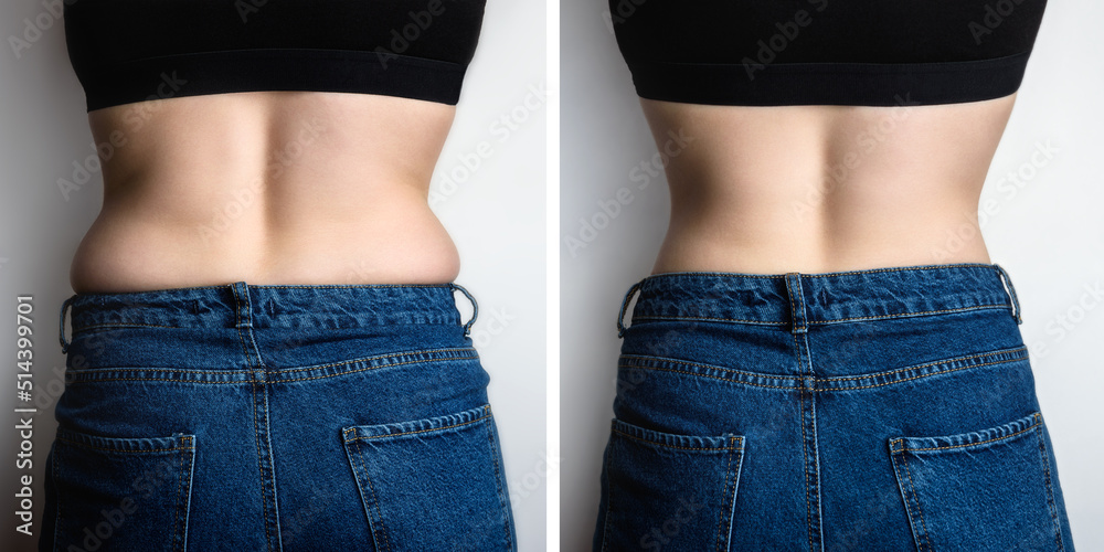 Slim and fat female sides on back comparison. Before and after weight ...