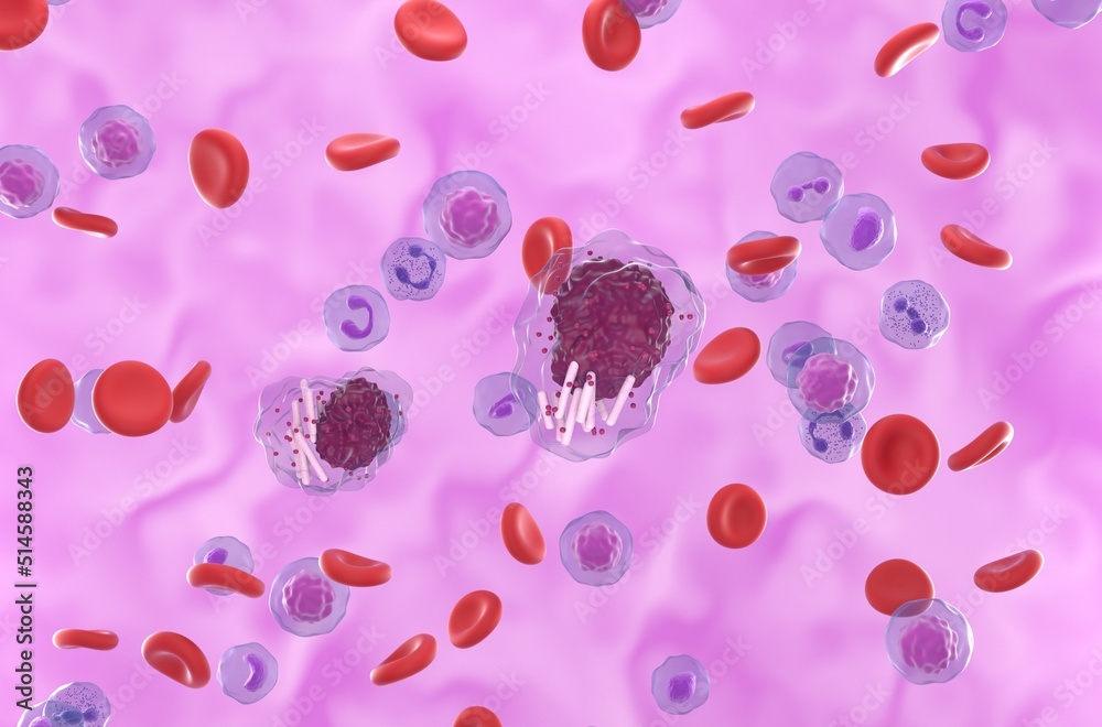 Chronic lymphocytic leukemia (CLL) cells in blood flow - isometric view ...