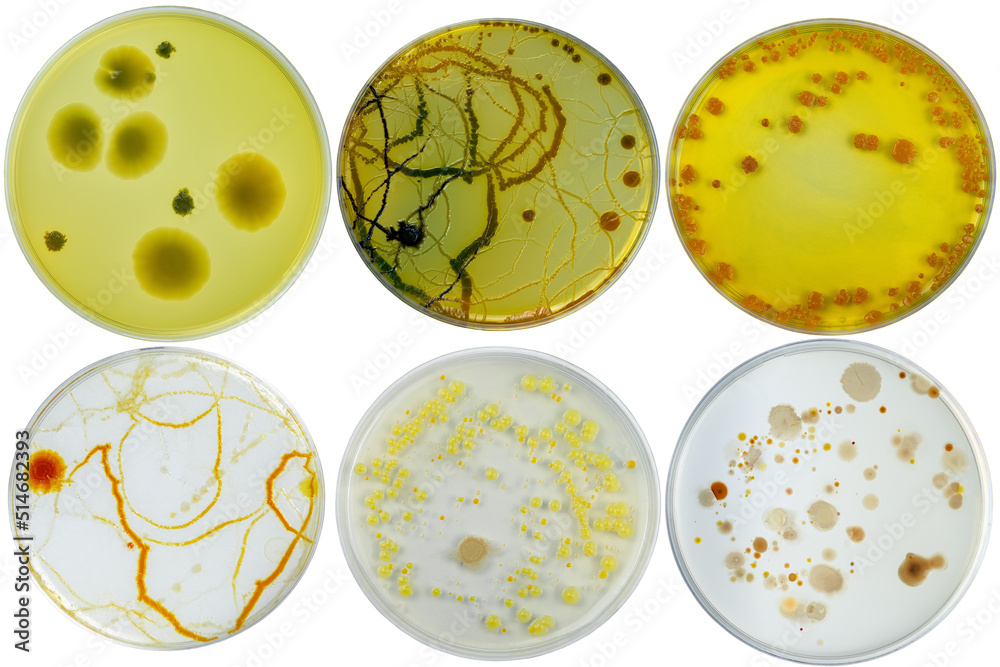 Hand with Petri dish or culture media with bacteria on white background ...
