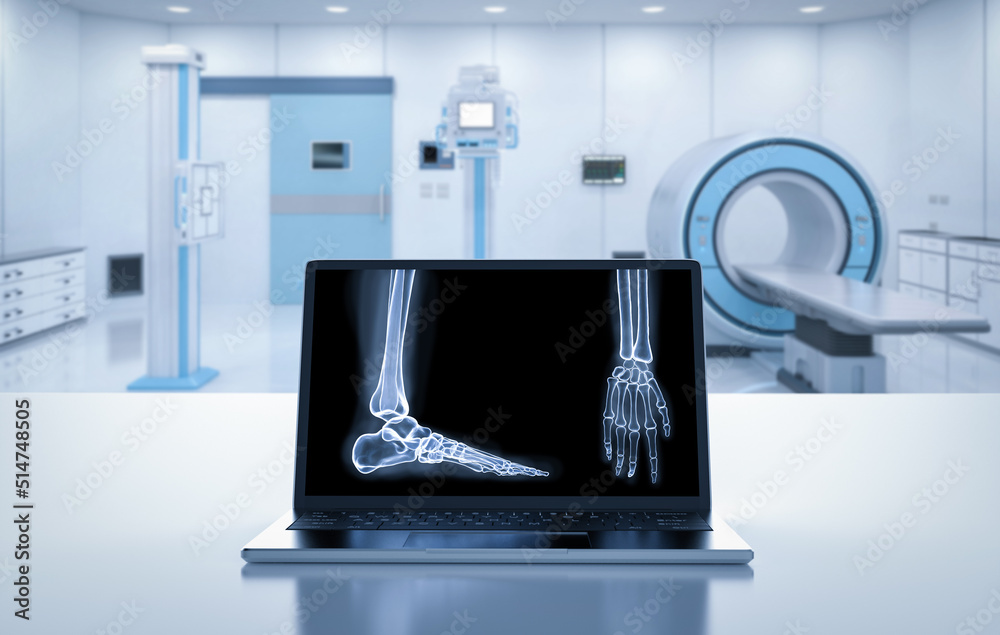 Hospital radiology room with computer notebook display x-ray film Stock ...