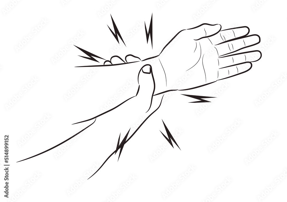 Broken or Sprained Wrist Diagram Outline Stock vector illustration ...