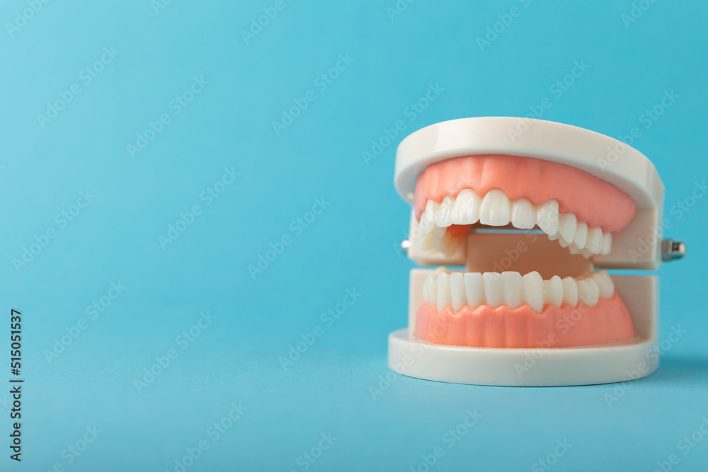 Dentures on a blue background.Upper and lower jaws with false teeth ...