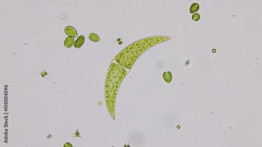 Bacteria and Protozoa in waste water under the microscope. Stock ビデオ ...