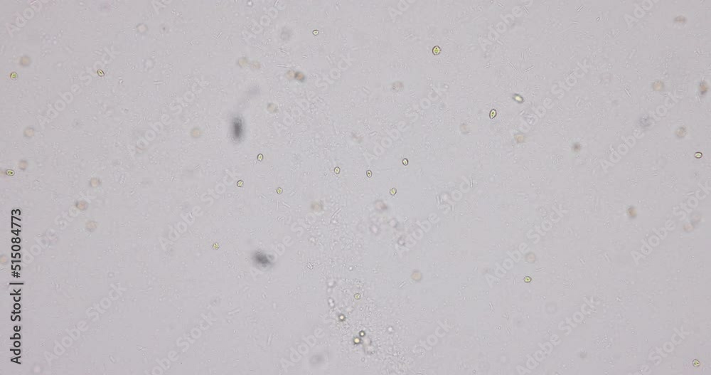 Bacteria and Protozoa in waste water under the microscope. Stock ビデオ ...
