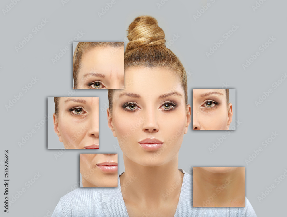 Effects of ageing,Frownscowl lines ,Nasolabial folds,Neck ,Under eye ...