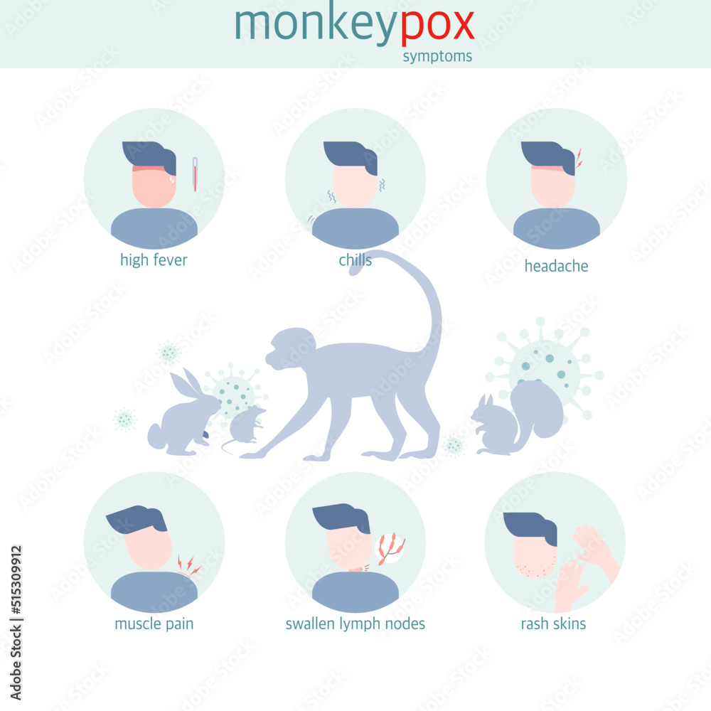 Monkeypox symptoms concept. High fever, headache, chills, muscle aches ...