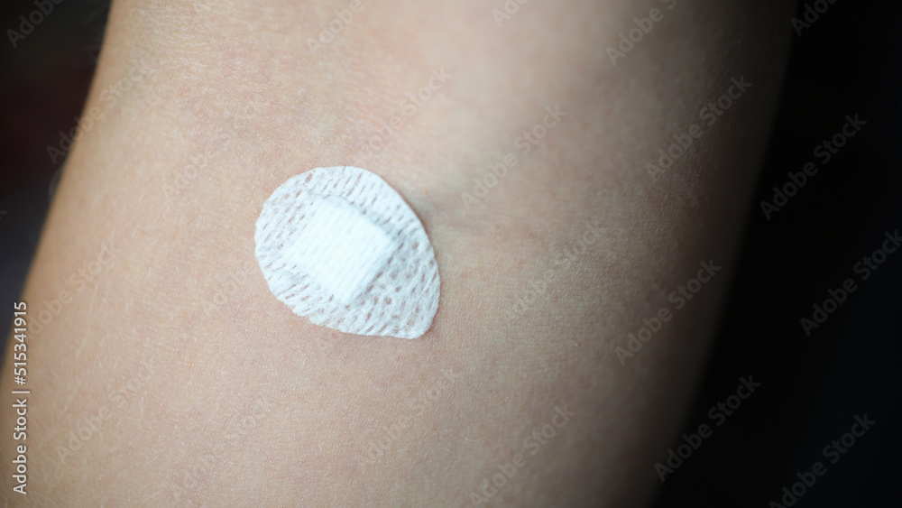 Small round patch stuck in place intravenous injection on forearm ...