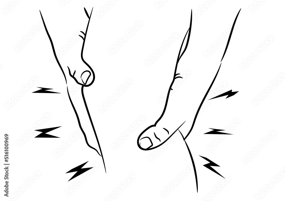 Tendon knee joint problems painful, swelling after from exercise vector ...