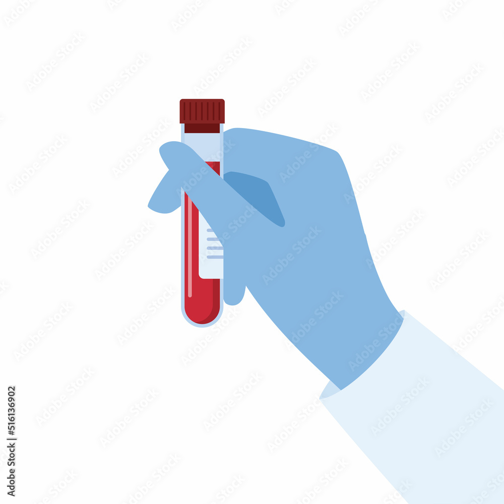 Doctor's hand in a medical glove holding test tube with blood ...