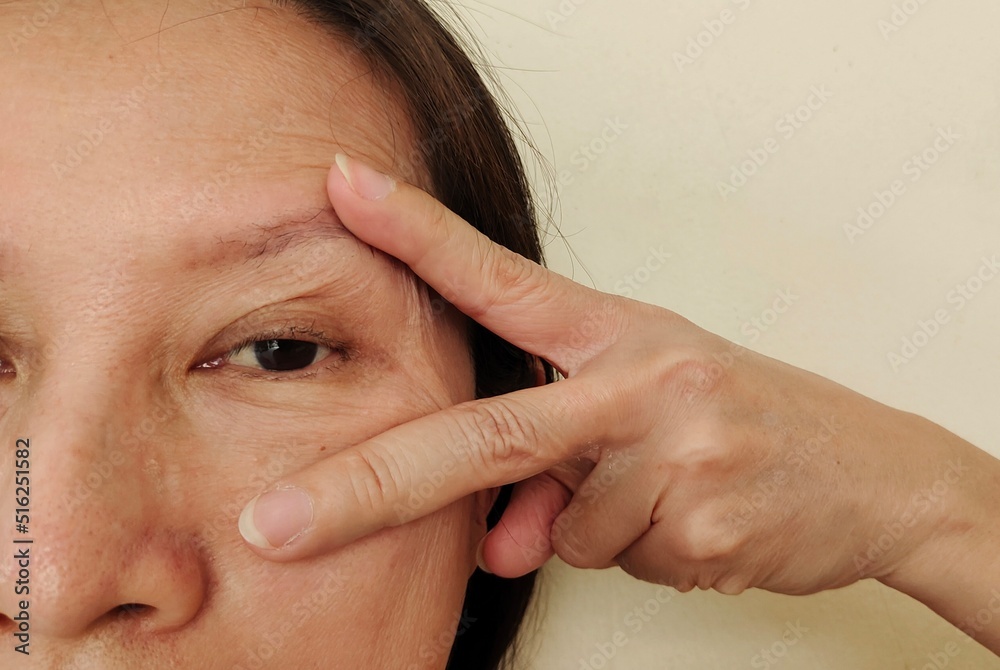 Foto de Portrait showing the fingers holding around the eye, problem ...